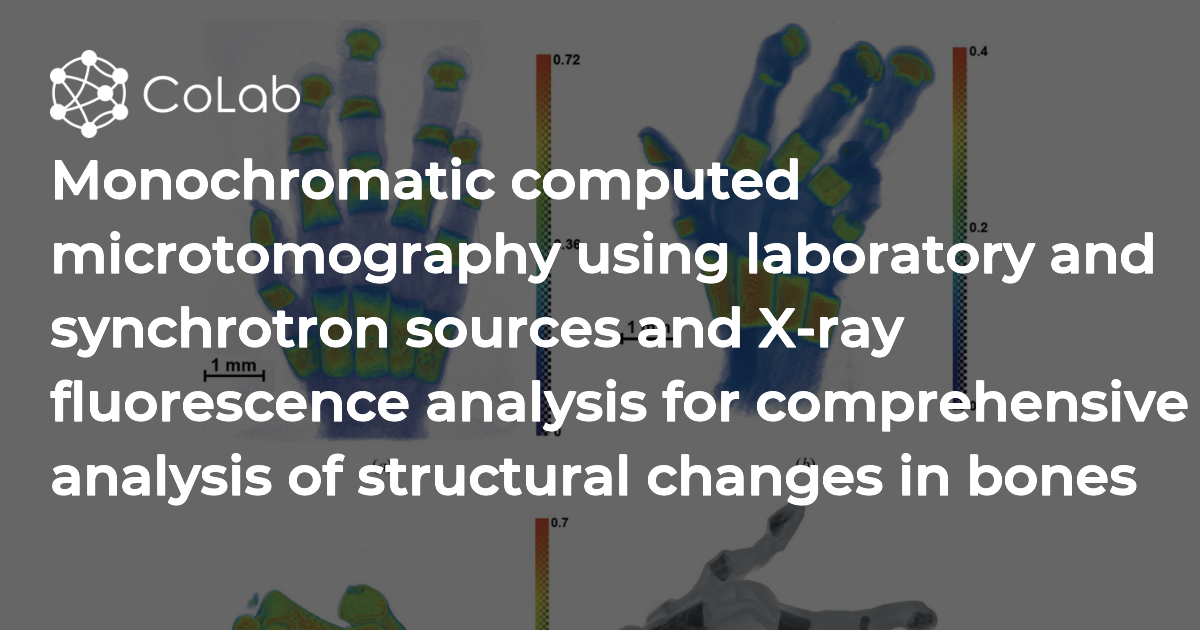 Monochromatic computed microtomography using laboratory and synchrotron ...