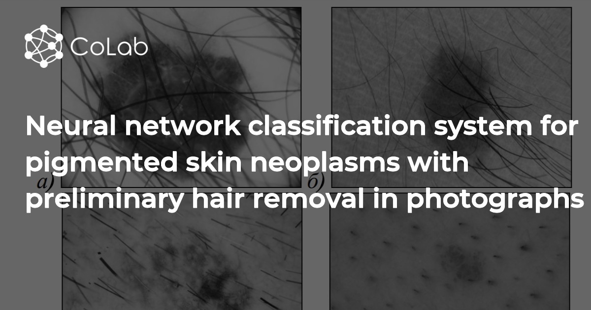 Neural network classification system for pigmented skin neoplasms with ...