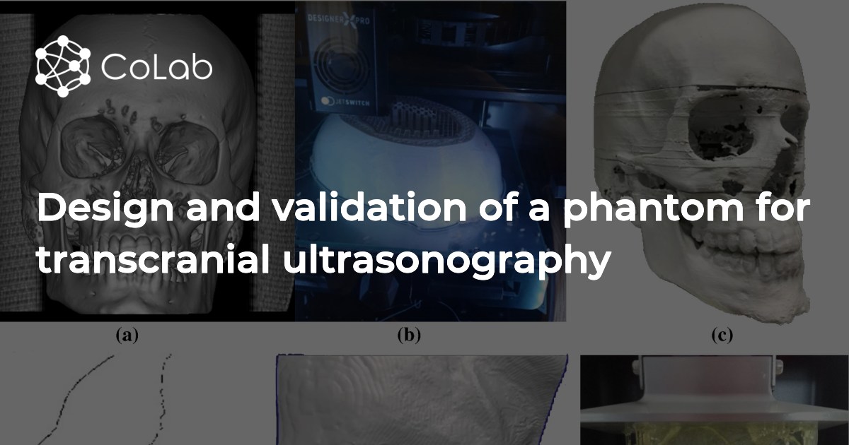 Design and validation of a phantom for transcranial ultrasonography | CoLab