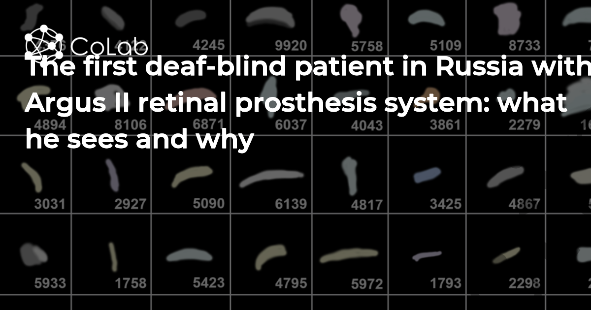 The first deaf-blind patient in Russia with Argus II retinal prosthesis ...