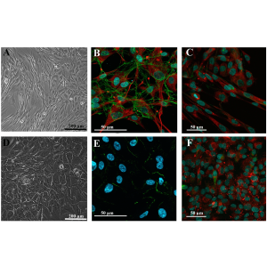 Cell spheroid fusion: beyond liquid drops model | CoLab