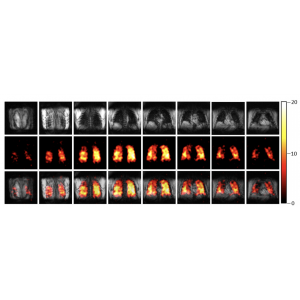 19F MRI of human lungs at 0.5 Tesla using octafluorocyclobutane | CoLab